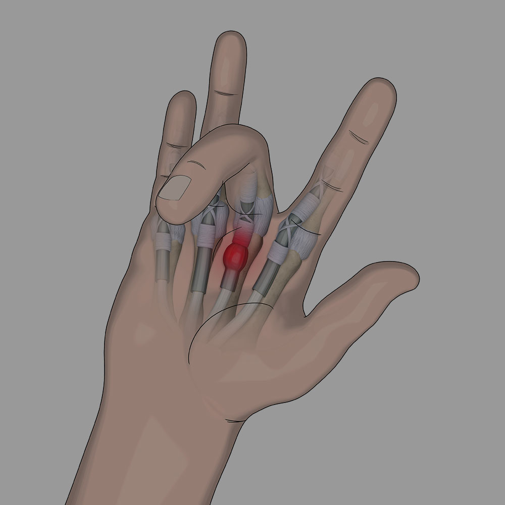 Kelowna Physiotherapy | Sun City Physiotherapy